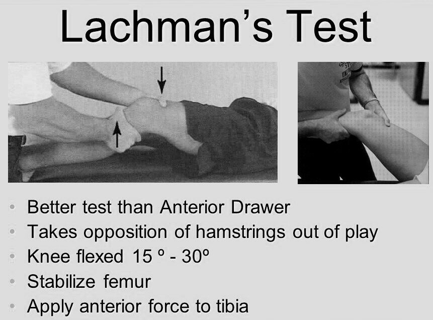 Knee Examination - PT Master Guide