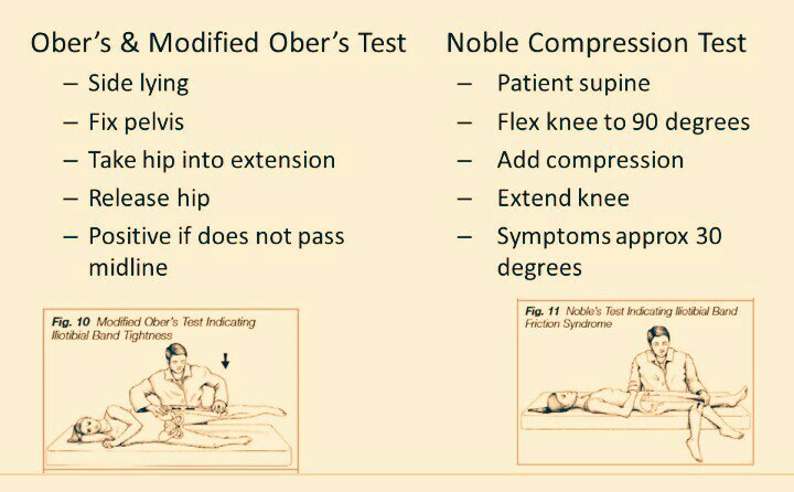 IlioTibial (IT) band Syndrome - PT Master Guide
