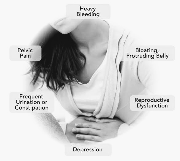Symptoms of Uterine Fibroids - PT Master Guide