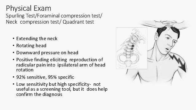 Spurling's Test - PT Master Guide