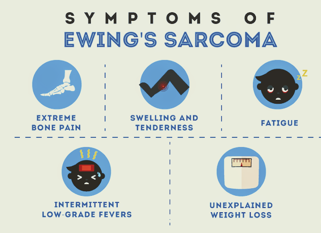 Sign and Symptoms of Ewing Sarcoma Archives - PT Master Guide