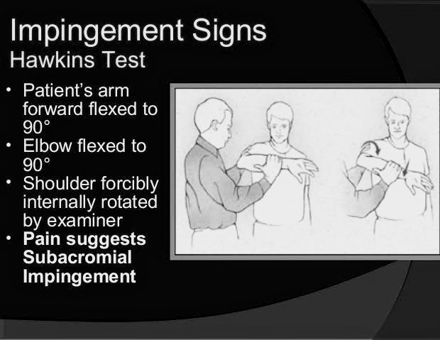 Hawkins Kennedy Test - PT Master Guide