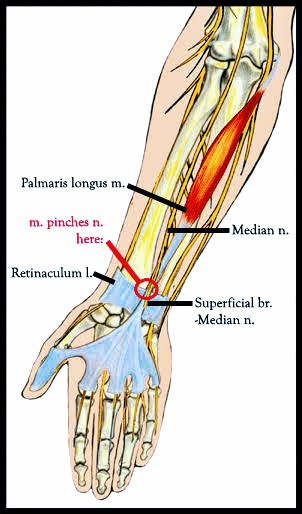 Palmaris longus muscle - PT Master Guide | PT Master Guide
